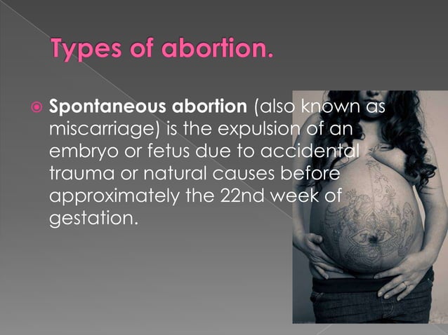 Abortion | PPTX