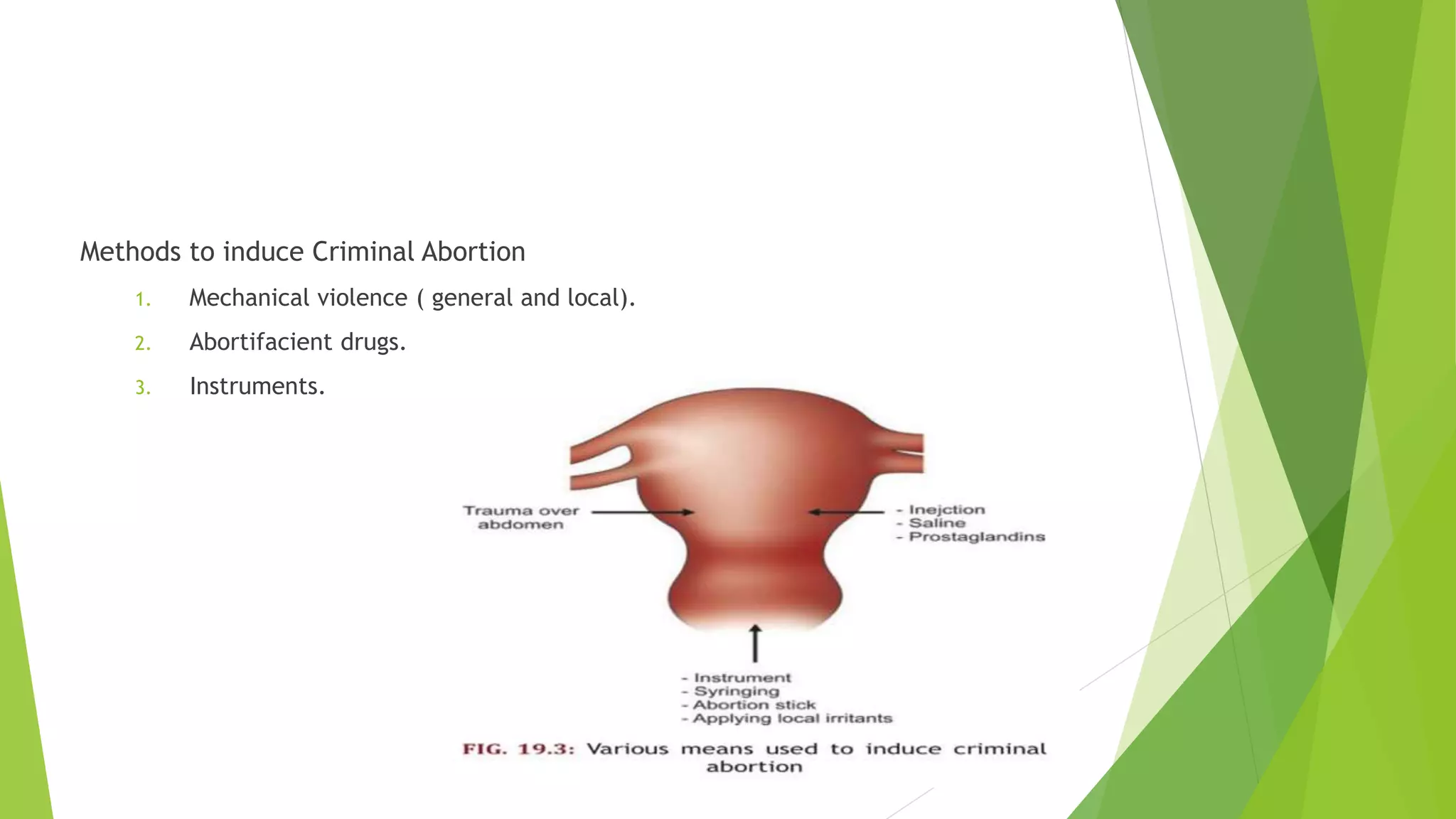 Abortion - Forensic | PPTX