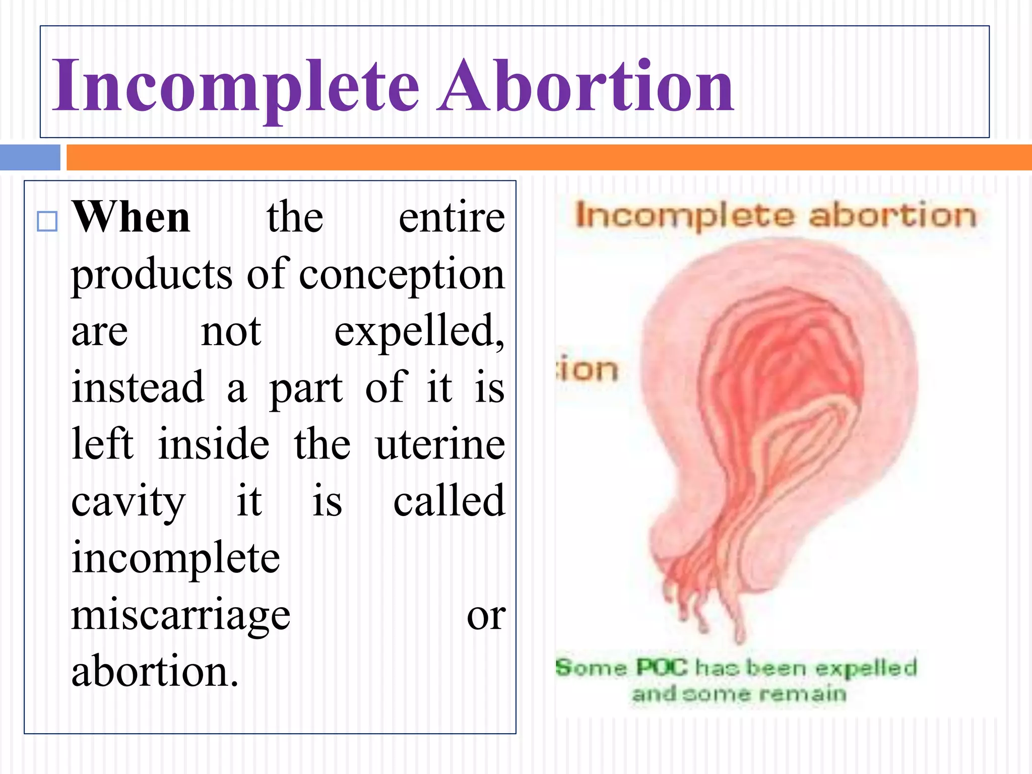 abortion ...pptx
