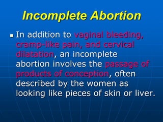 Abortion.ppt