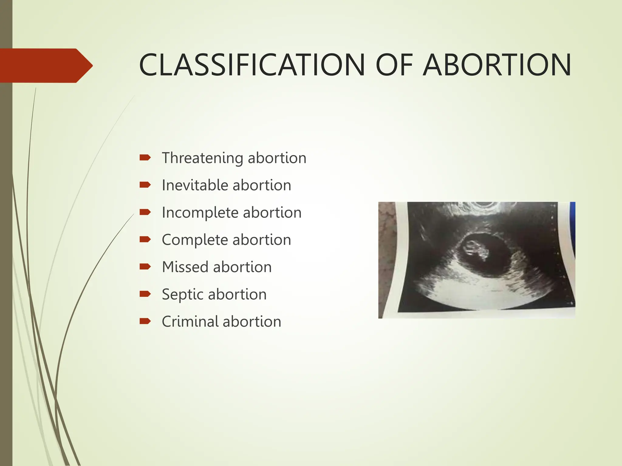 abortion.pptx