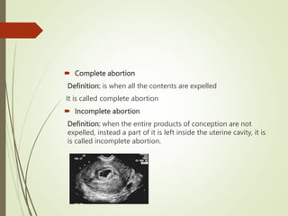 abortion.pptx