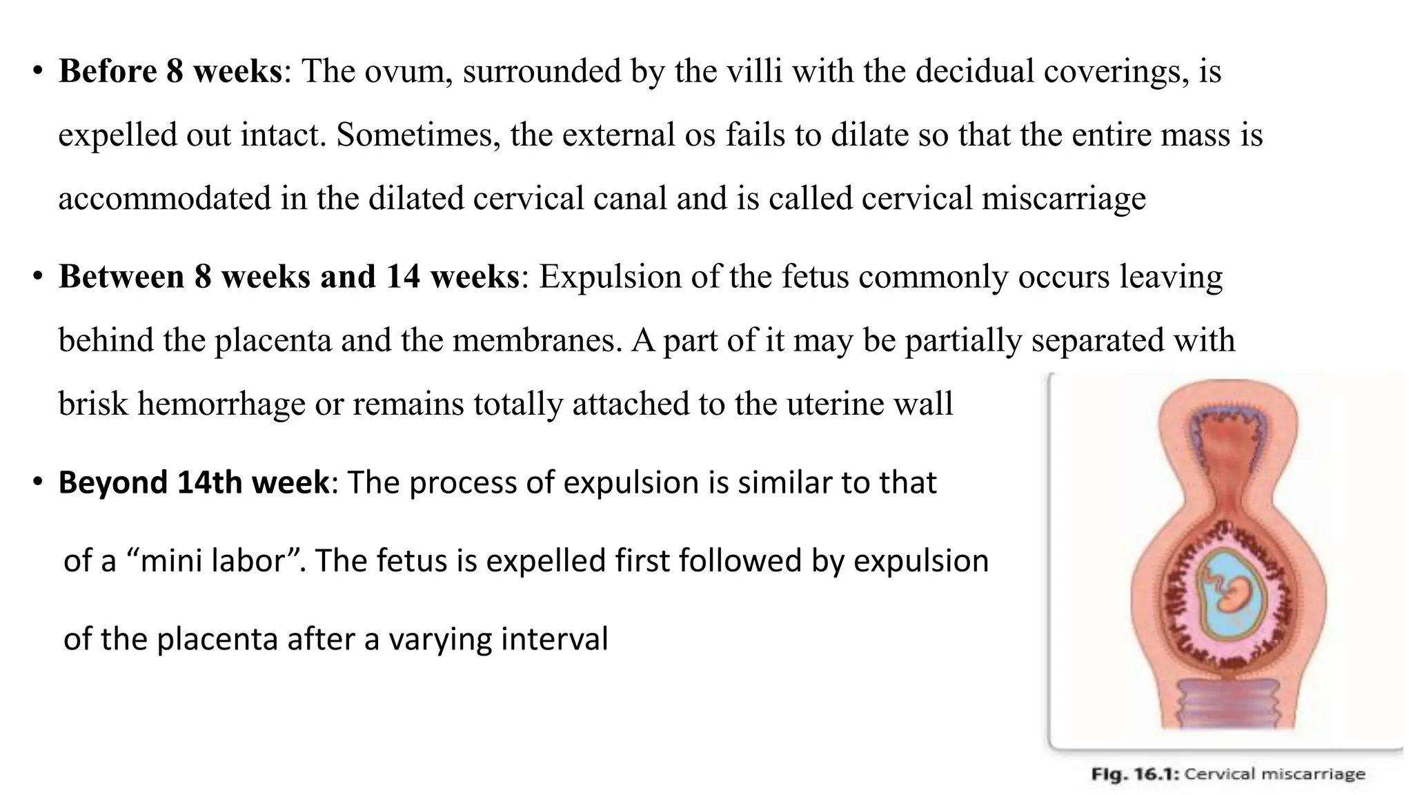 PATHOPHYSIOLOGY OF ABORTION PDF. NET PRESENTATION | PPTX