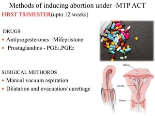 ABORTION | PPTX