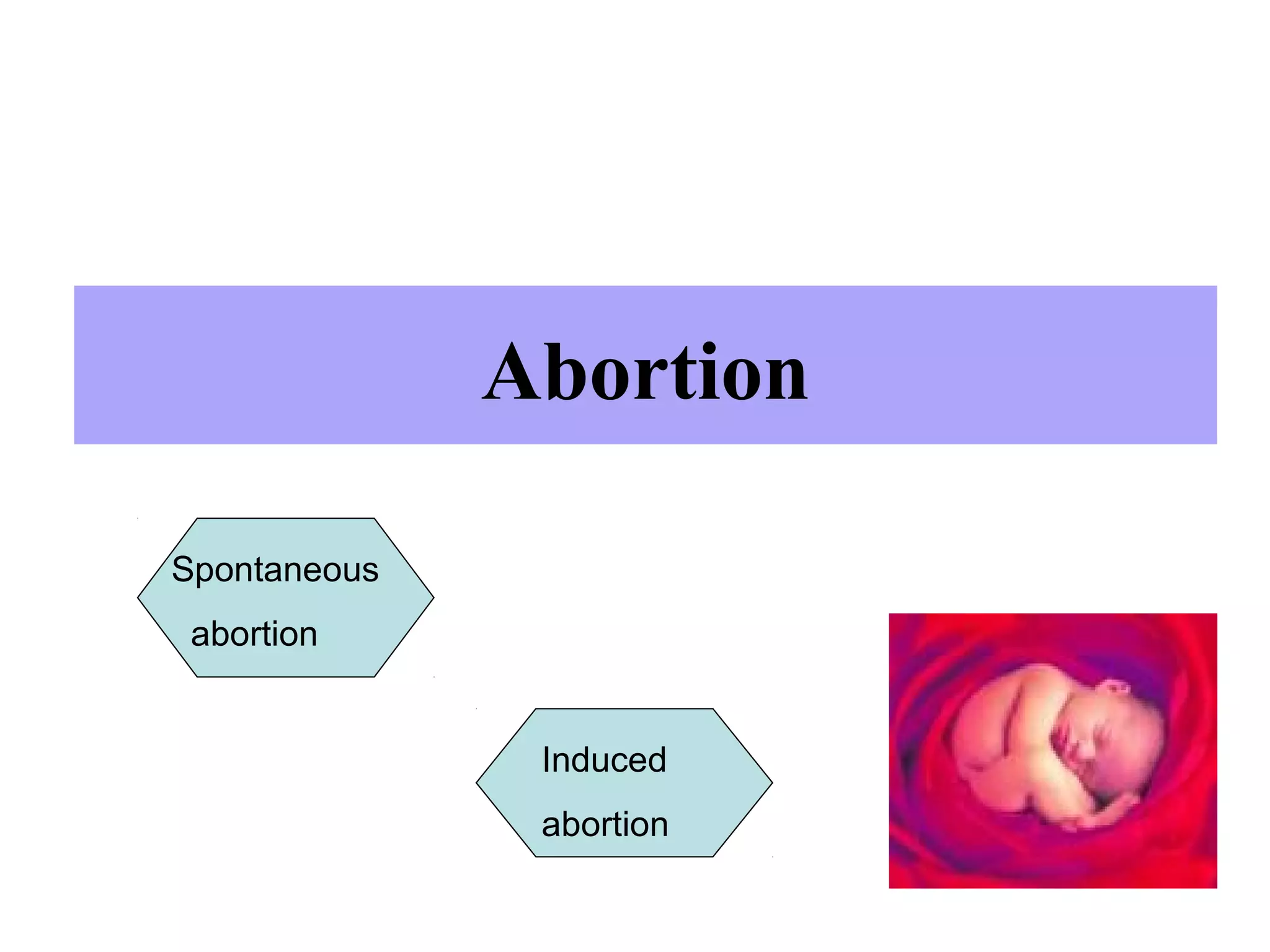 Abortion Ectopic Pregnancy Hyperemesis Gravidarum | PPT