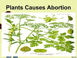 Abortion forensic medicine ppt | PPT