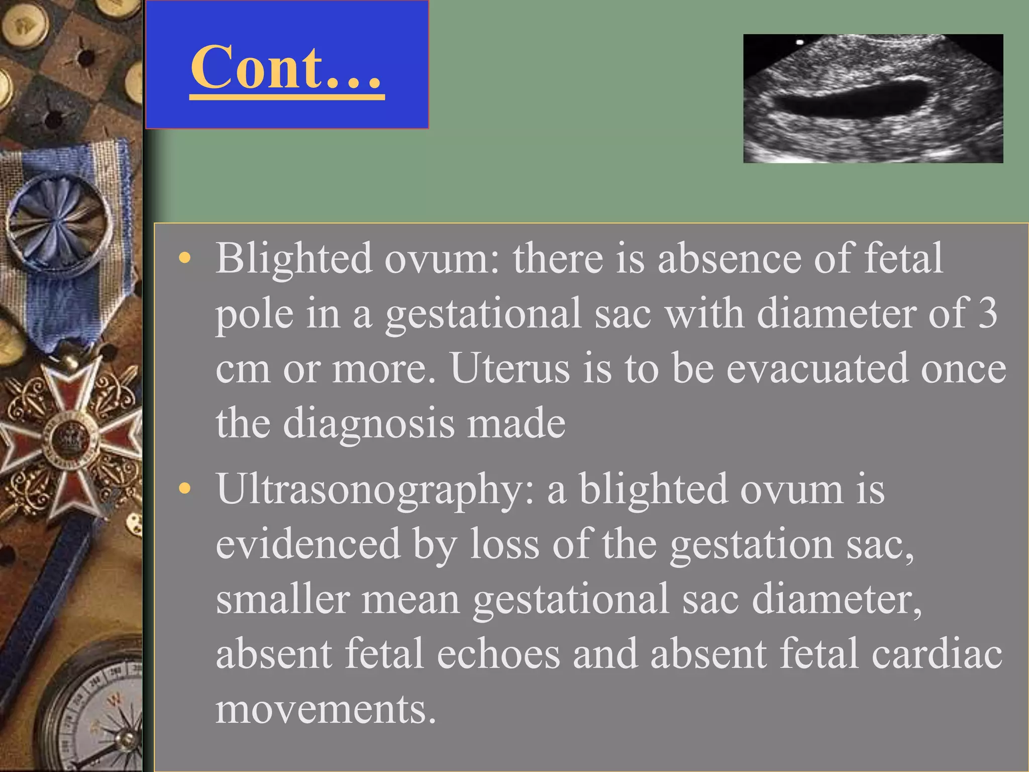 Abortion -Type and it's Management | PPTX
