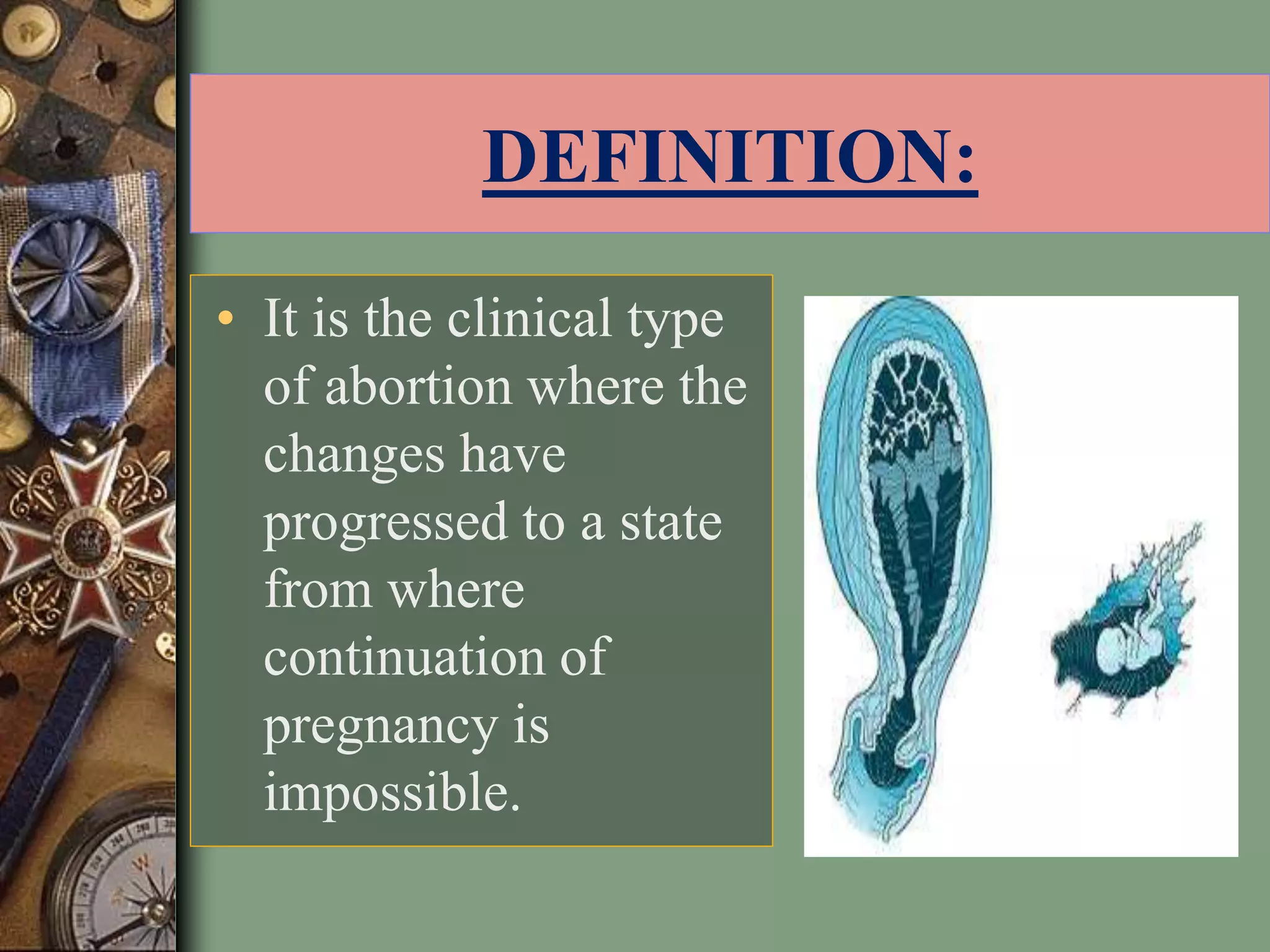 Abortion -Type and it's Management | PPTX