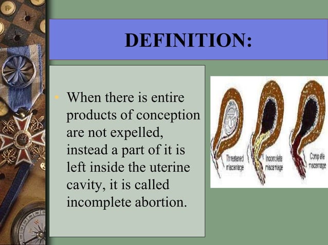 Abortion -Type and it's Management | PPTX | Pregnancy | Reproductive Health