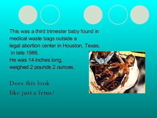 Abortion | PPT | Pregnancy | Reproductive Health