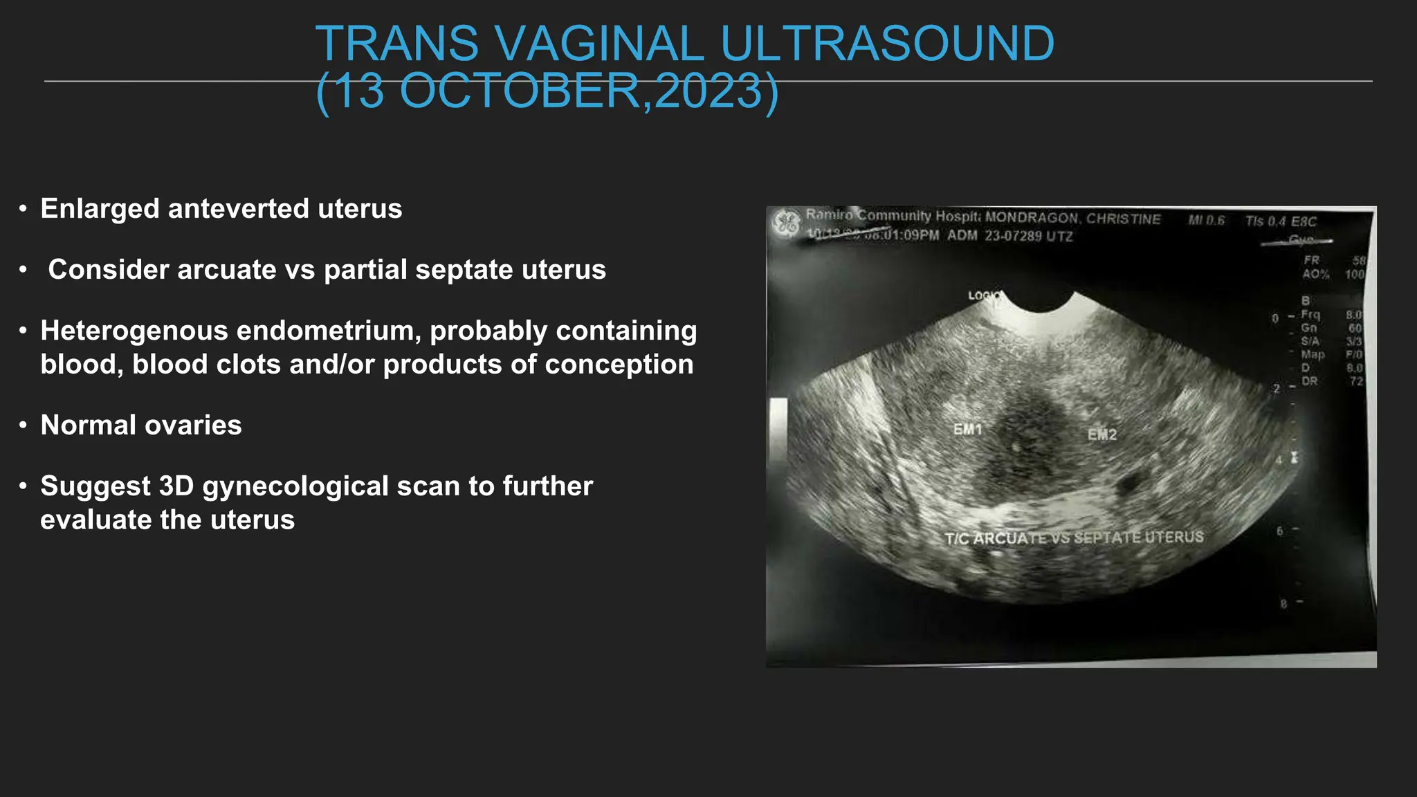 types of abortion in women,complete,incomplete | PPTX