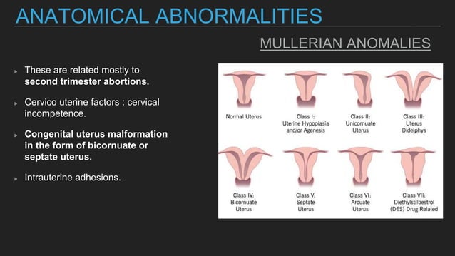 types of abortion in women,complete,incomplete | PPT