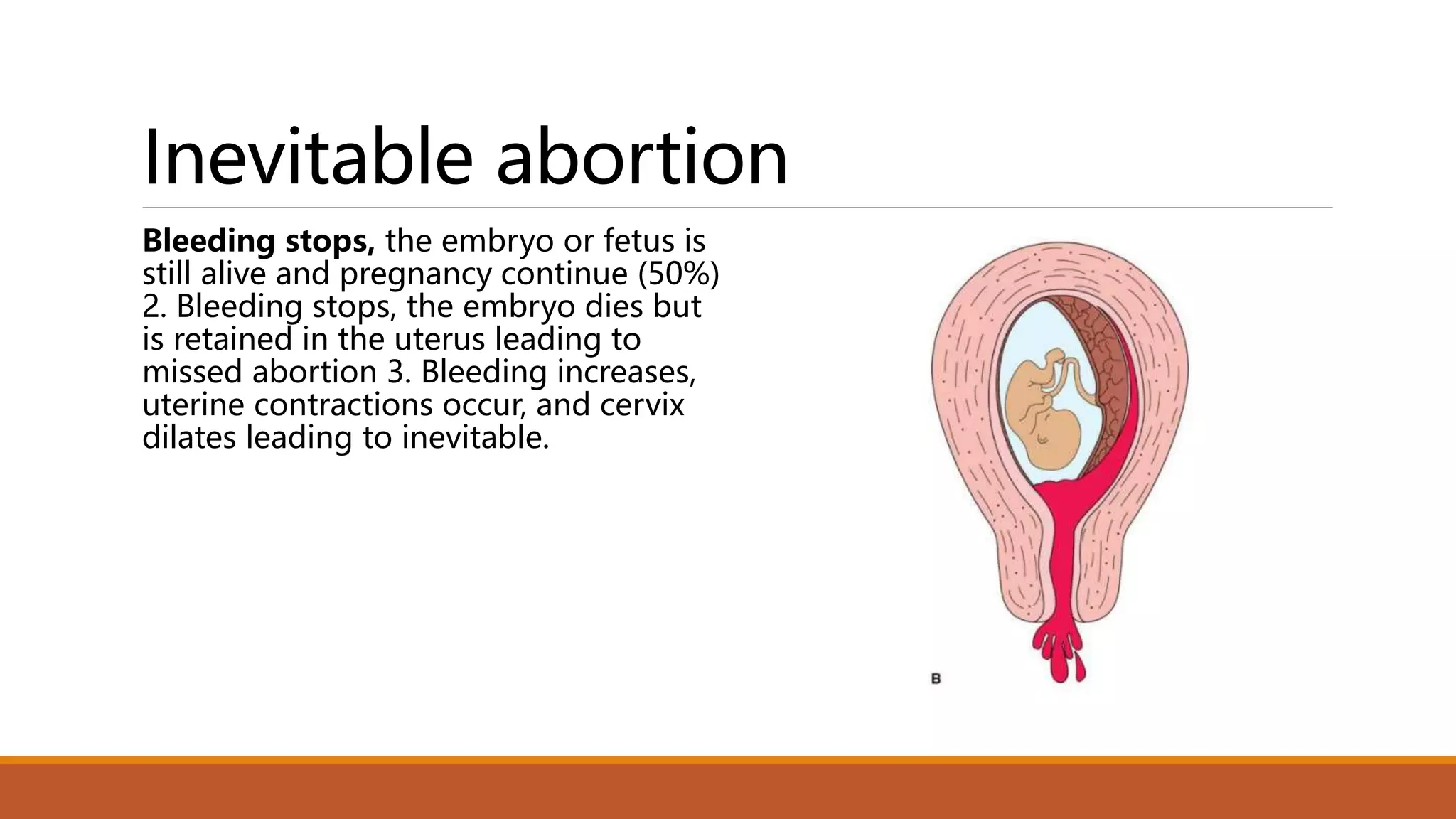 ABORTION PPT (1).pptx