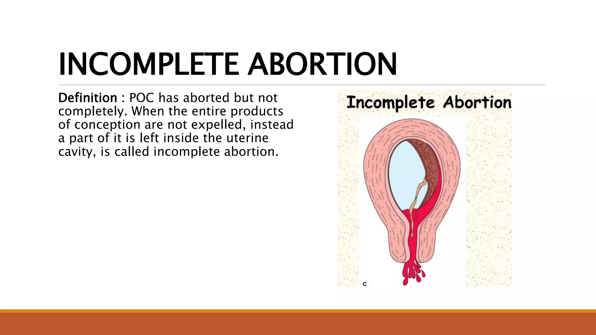 ABORTION PPT (1).pptx