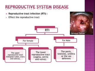 Abortion & reproductive tract cancer | PPTX