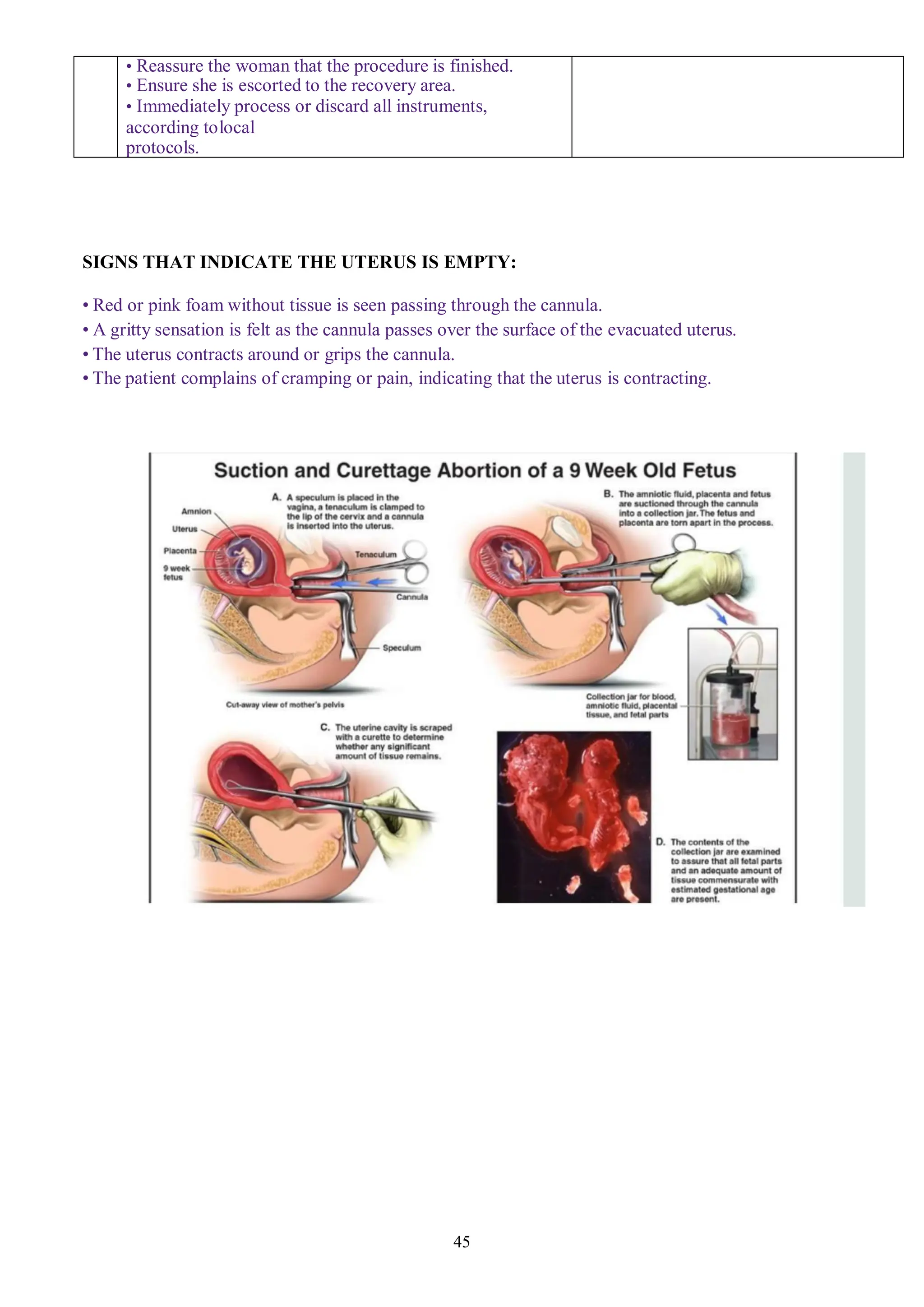 What is Abortions , it's types and management | PDF