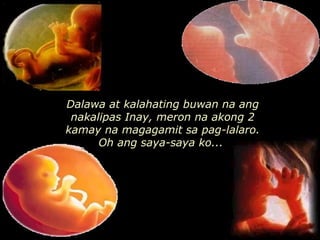Abortion(Tagalog) | PPS