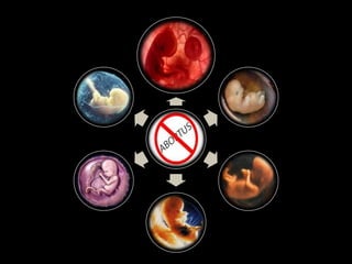 Abortion types | PPT