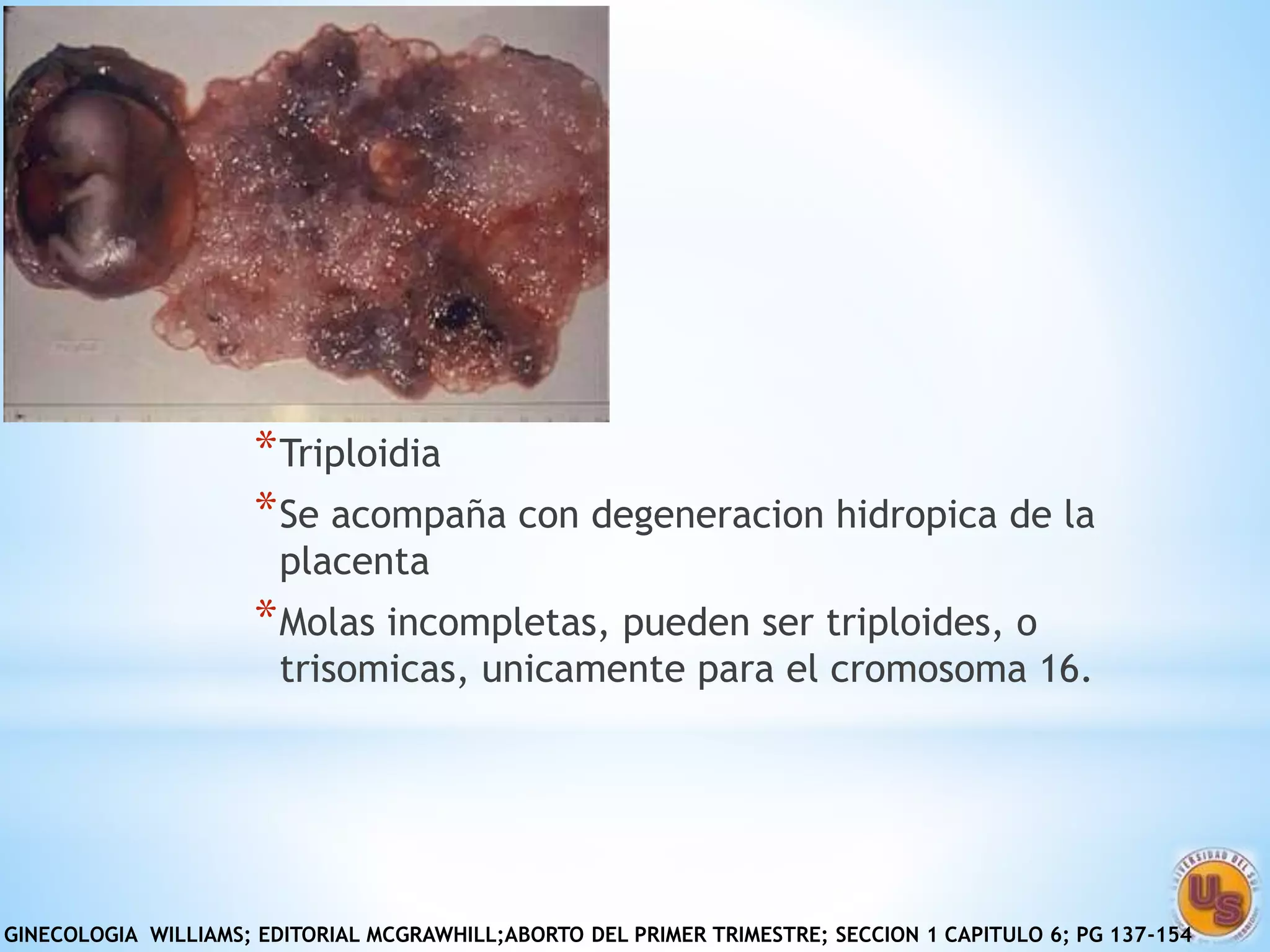 Aborto del primer trimestre | PPTX