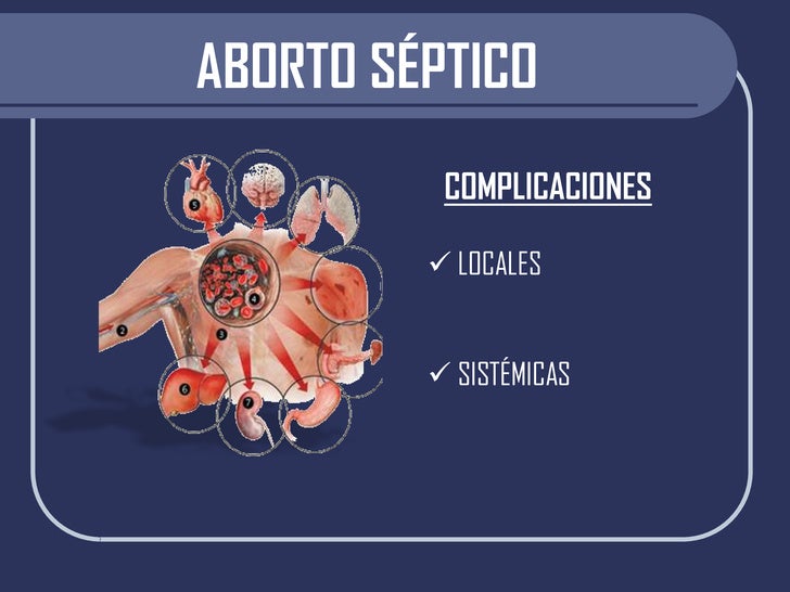 Aborto séptico