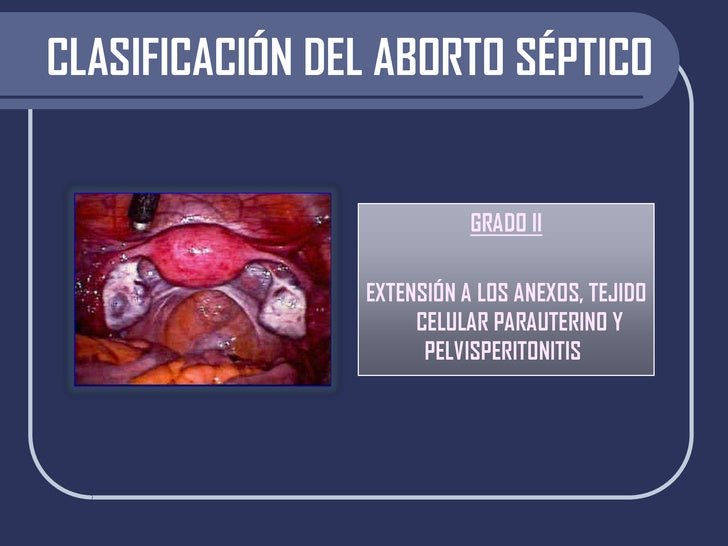 Aborto séptico
