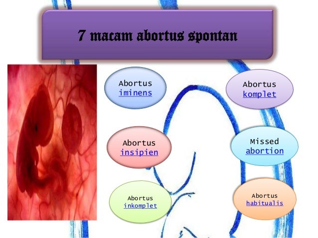 Abortus