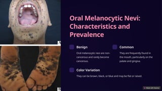 About-Kaposi-Sarcoma-Oral-Melanoma-and-Pigmented-Nevi-in-Oral-Medicine.pptx