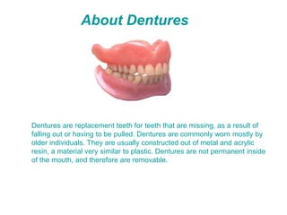 aboutdenture in dentals-100811052540-phpapp02 (1).ppt