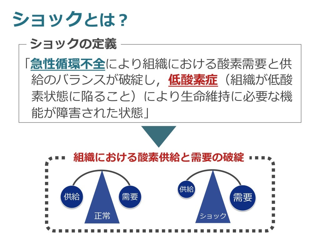 ショックについて