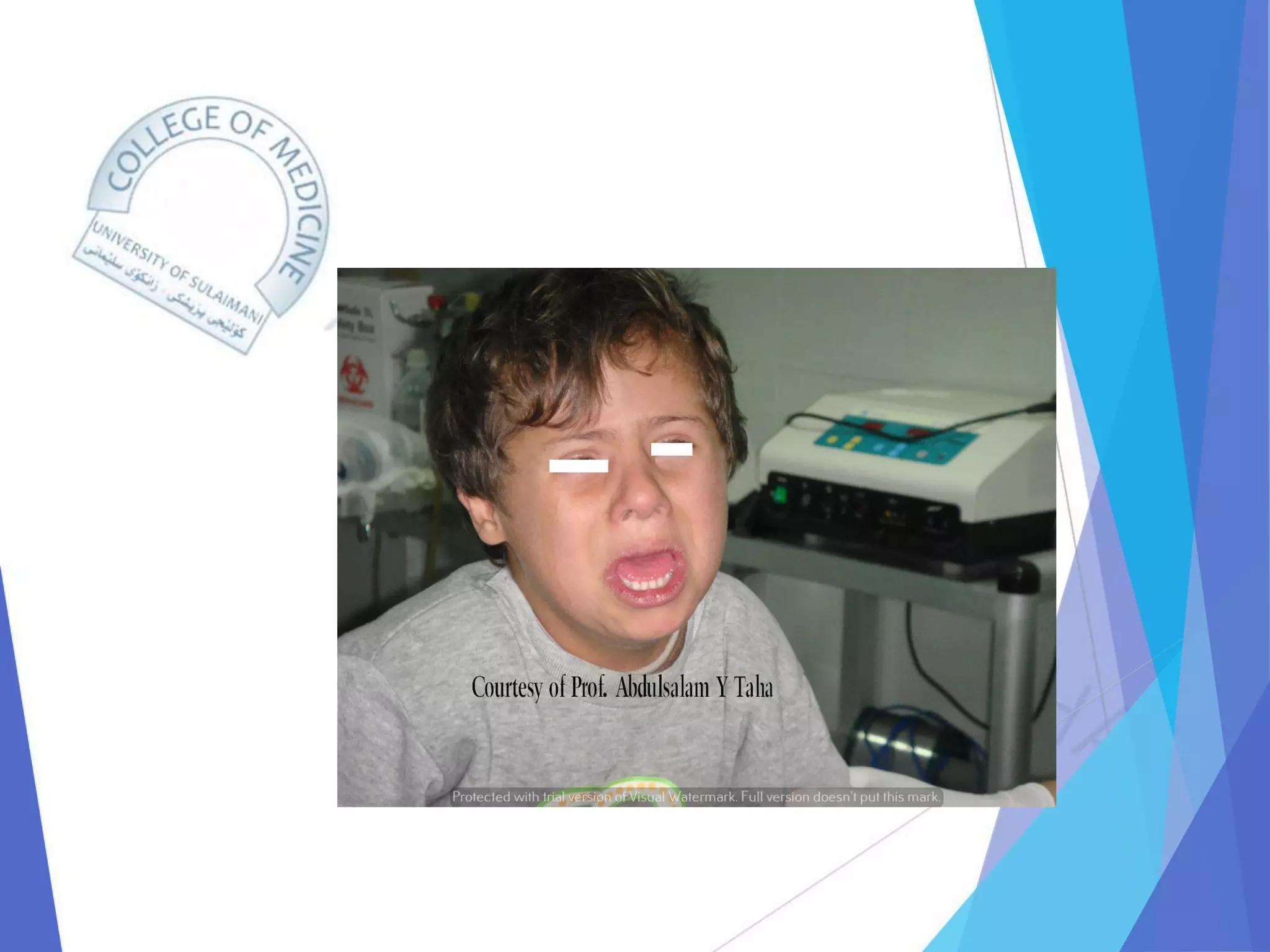 A Boy with Down Syndrome and a Sunflower Sead in the Trachea.pdf
