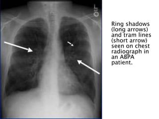 Abpa | PPT