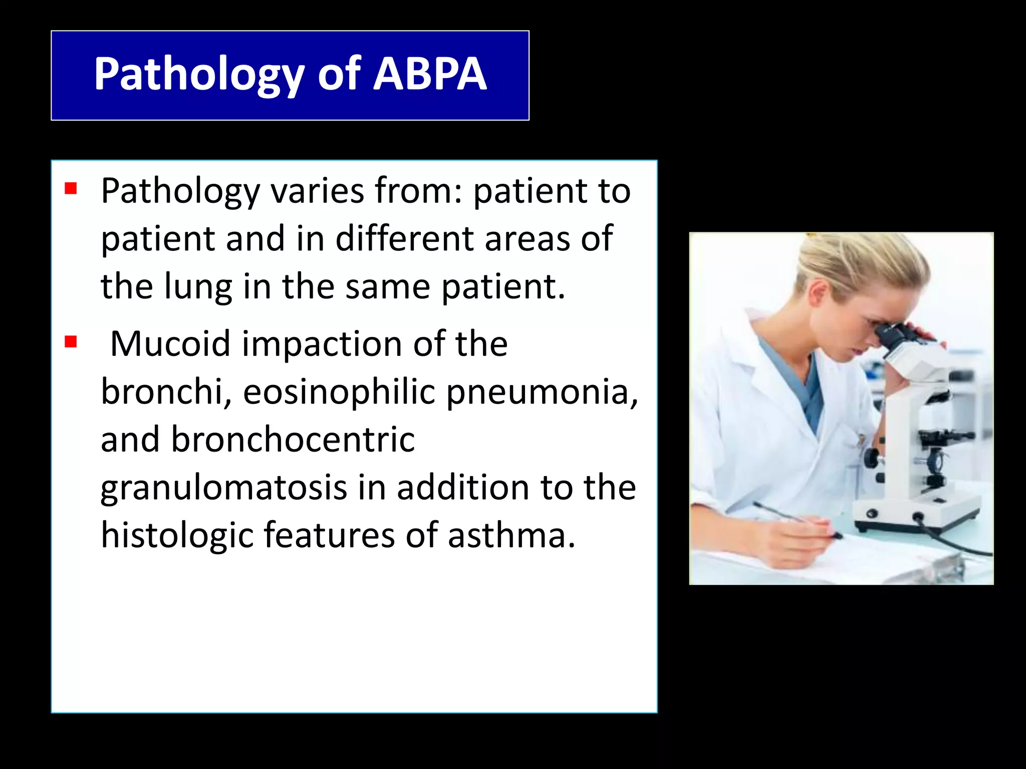 Allergic Broncho Pulmonary Aspergillosis (ABPA) by Dr.Tinku Joseph ...