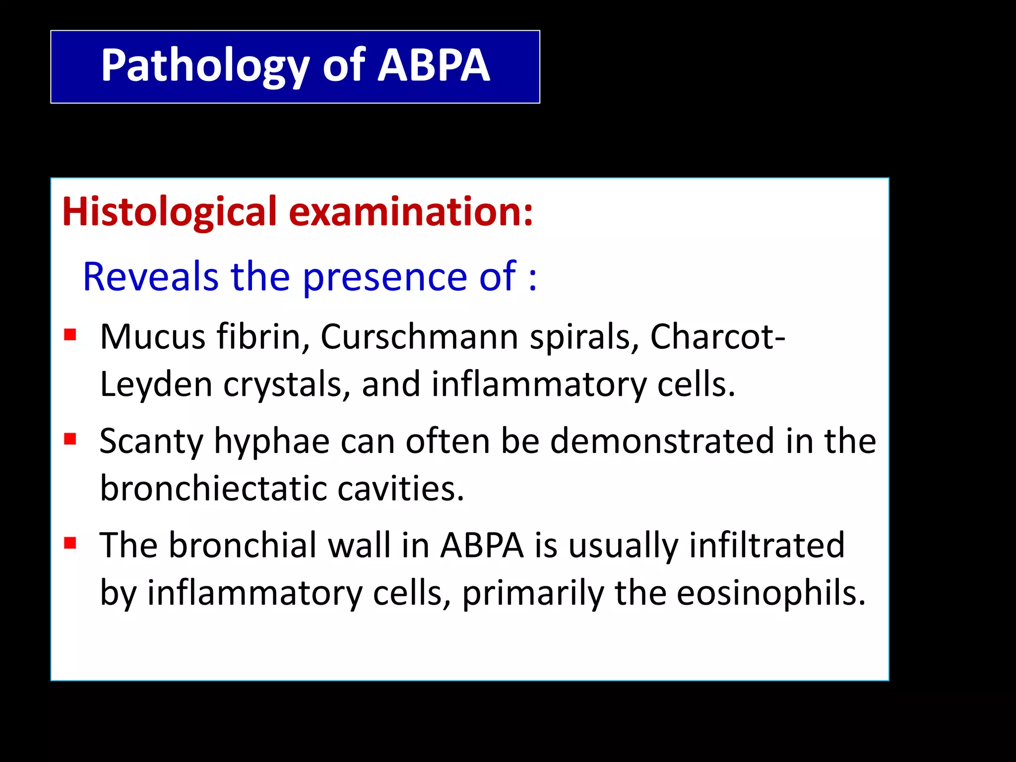 Allergic Broncho Pulmonary Aspergillosis (ABPA) by Dr.Tinku Joseph | PPTX