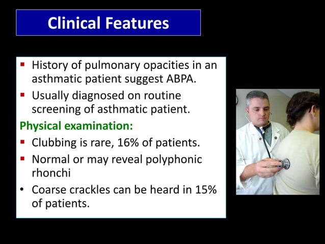 Allergic Broncho Pulmonary Aspergillosis (ABPA) by Dr.Tinku Joseph ...