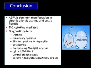 Allergic Broncho Pulmonary Aspergillosis (ABPA) by Dr.Tinku Joseph | PPT