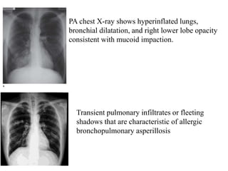 ABPA | PPTX