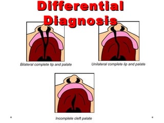 Abnormal Psychology: Neurodevelopmental Disoders | PPT