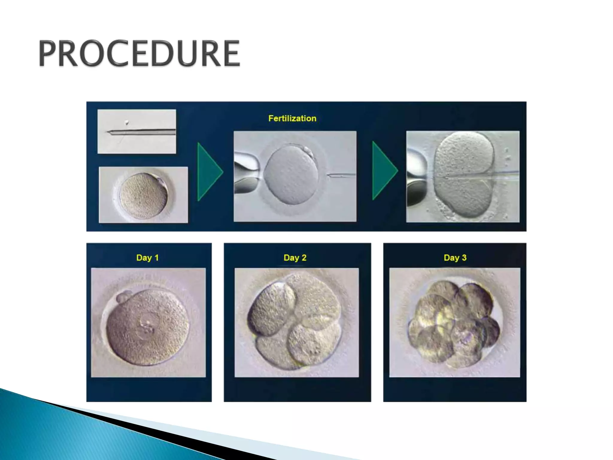Artificial Reproductive Technology | PPTX