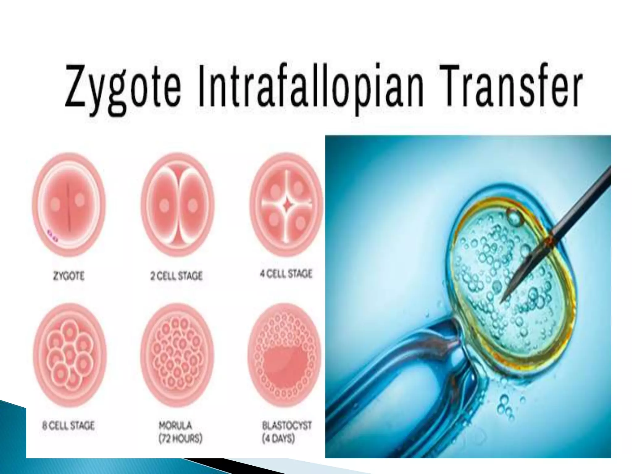Artificial Reproductive Technology | PPTX