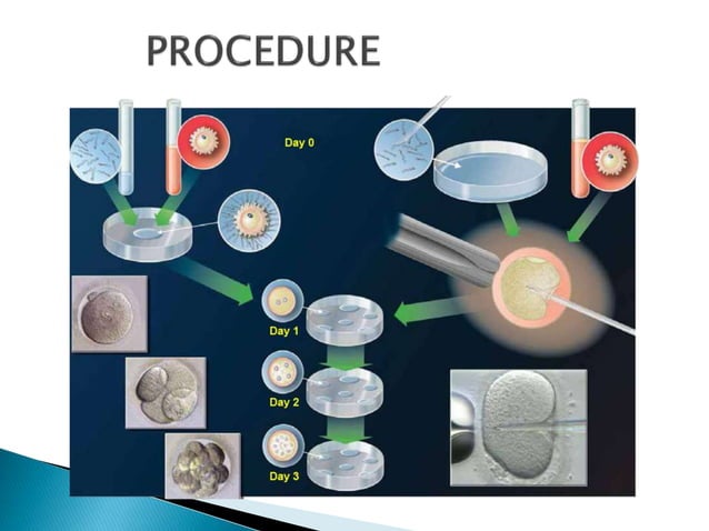 Artificial Reproductive Technology | PPT