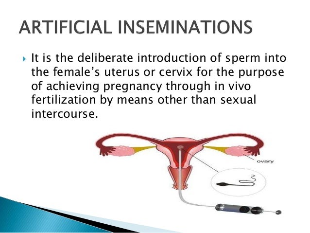 Artificial Reproductive Technology