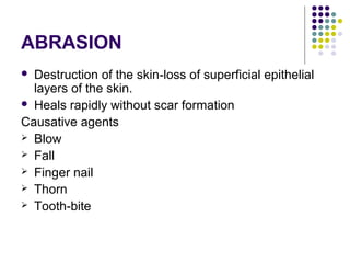 Abrasion Definition