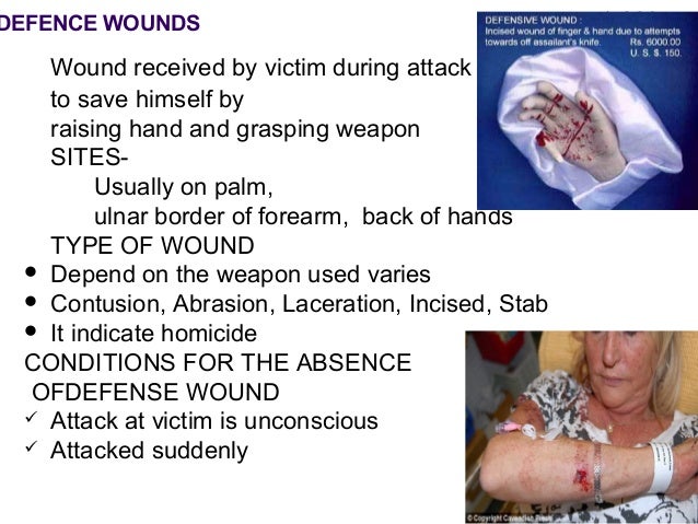 Abrasion Wound Diagram
