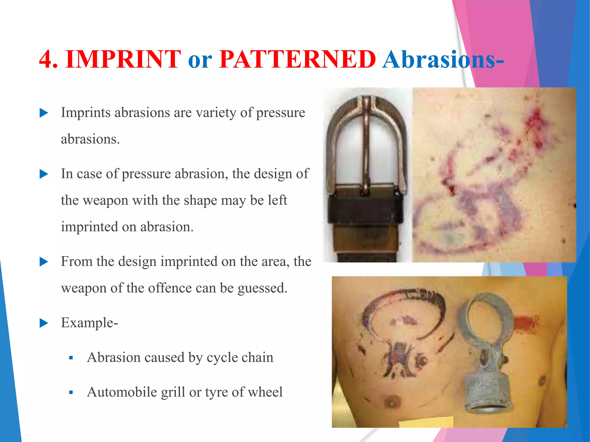 Abrasion | PPTX