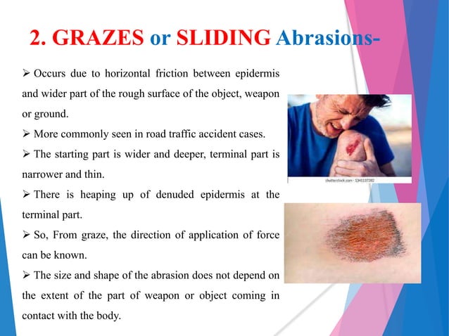 Abrasion | PPTX