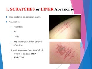 Abrasion | PPTX