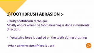 Abrasion ( Regressive Alterations of Teeth) | PPTX
