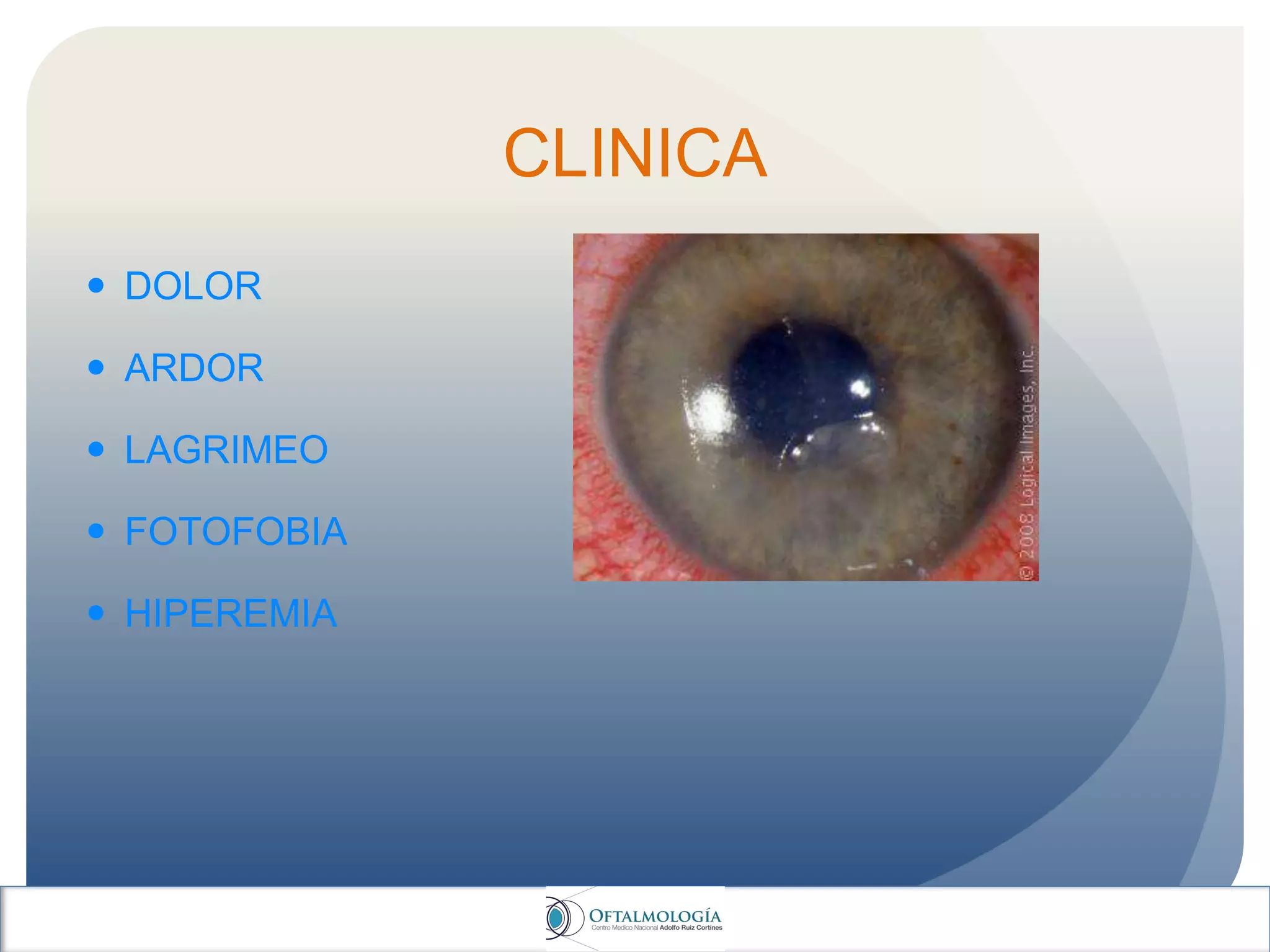 Abrasión corneal y cuerpo extraño corneal 2015 | PPT