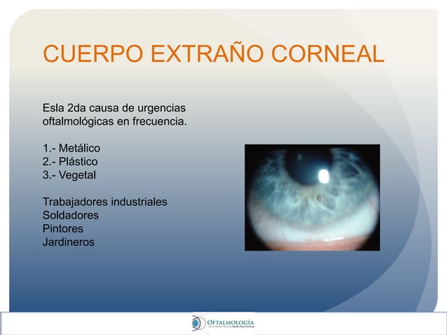 Abrasión corneal y cuerpo extraño corneal 2015 | PPTX | Eye and Vision ...