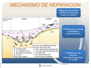 Abrasión corneal y cuerpo extraño corneal 2015 | PPTX | Eye and Vision ...